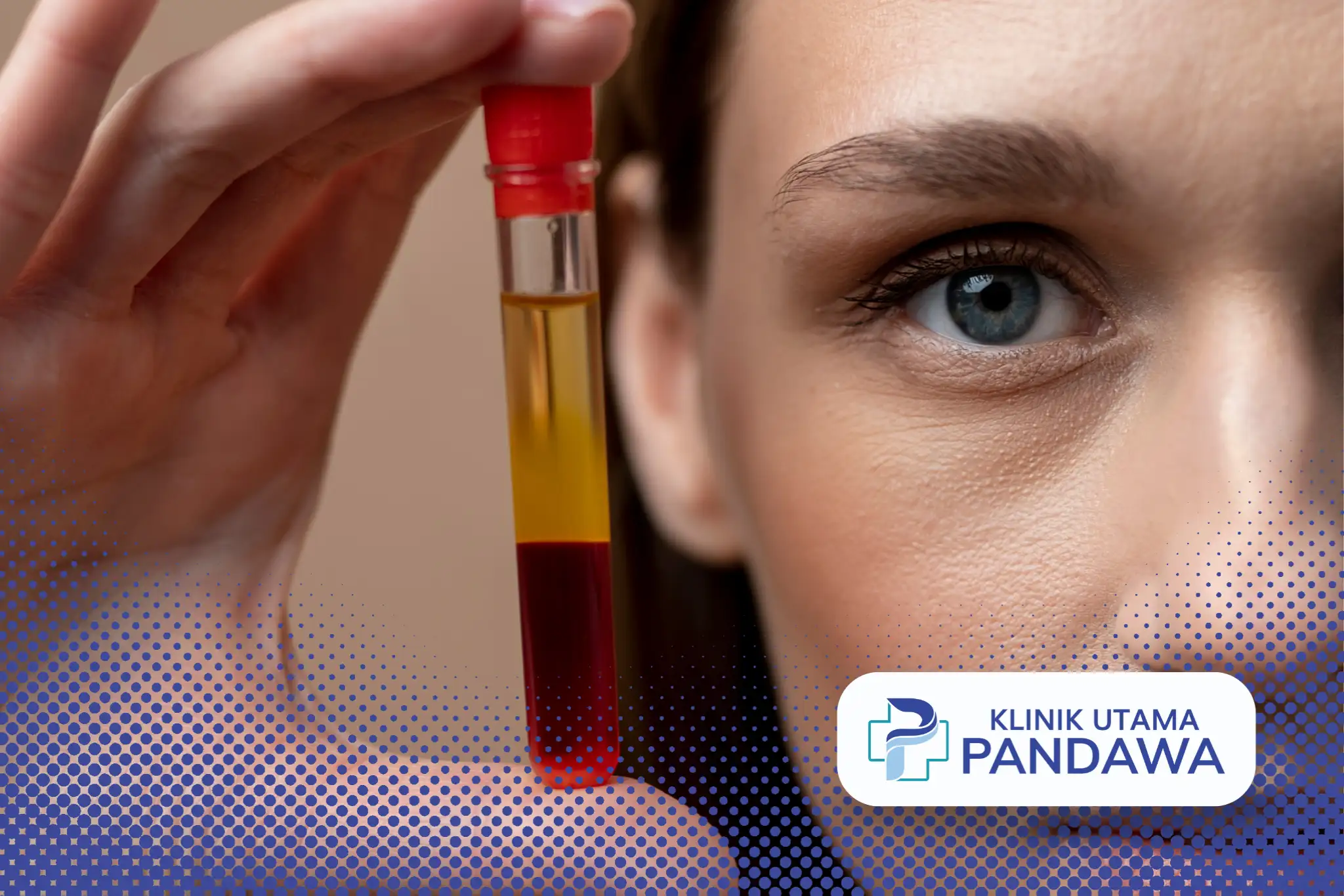 PRP Treatment: Rahasia Kulit Glowing dari Darah Sendiri - Klinik Utama ...