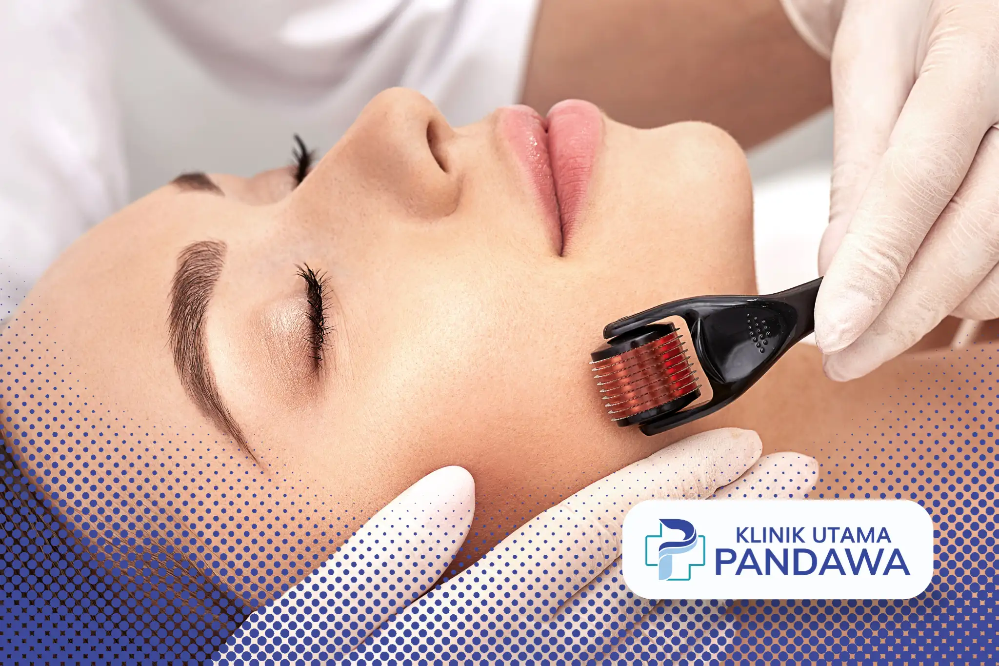 Dermaroller: Manfaat, Cara Kerja, dan Keamanannya - Klinik Utama Pandawa