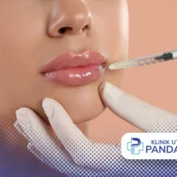 Kista Ateroma: Penyebab, Gejala, dan Cara Mengatasinya - Klinik Utama ...