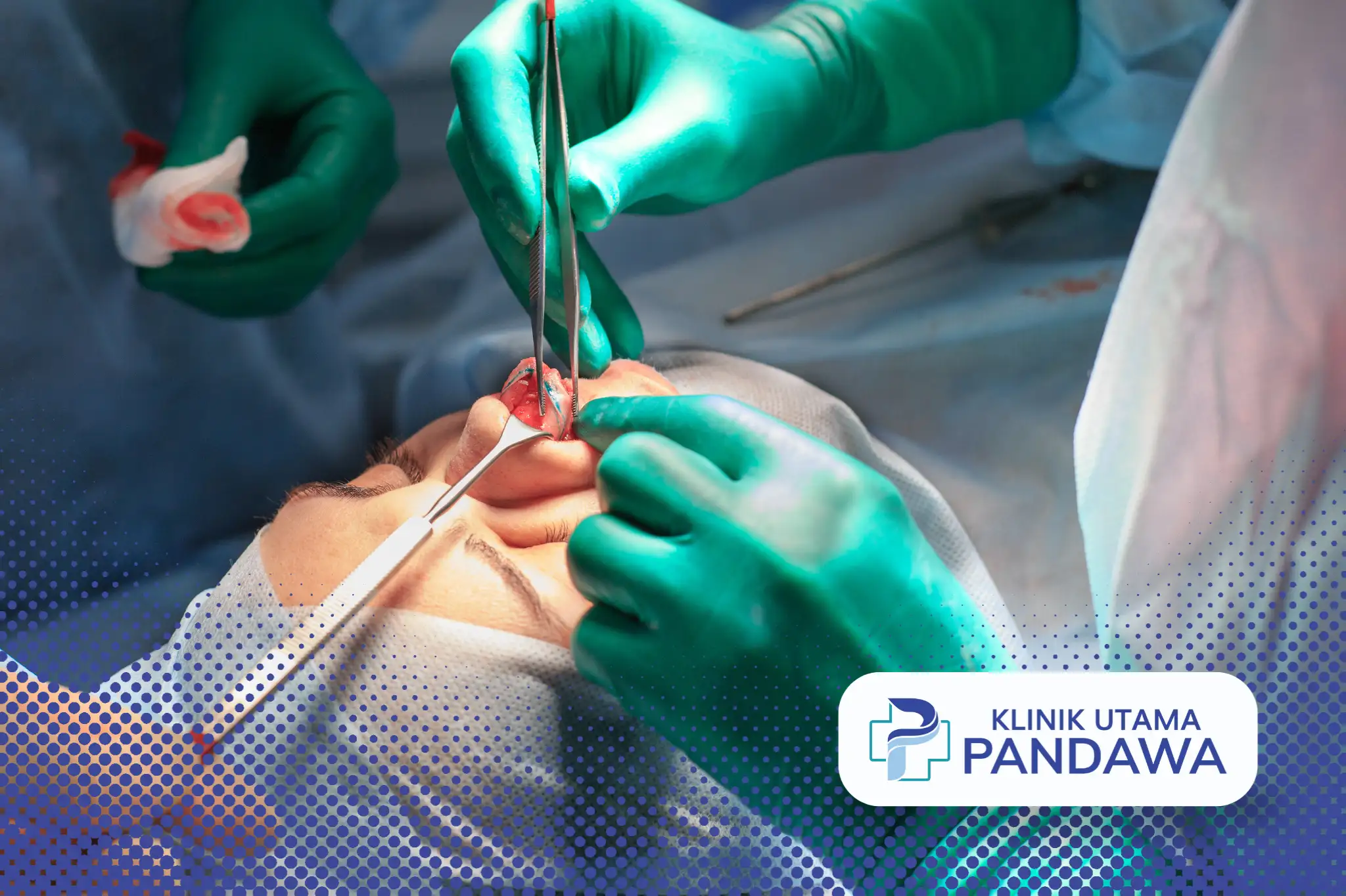 Operasi Hidung Pesek: Solusi untuk Tampil Lebih Percaya Diri - Klinik ...